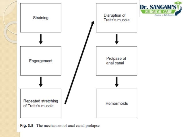 Hemorrhoids - Piles | PPTX | Digestive Disorders | Diseases and Conditions