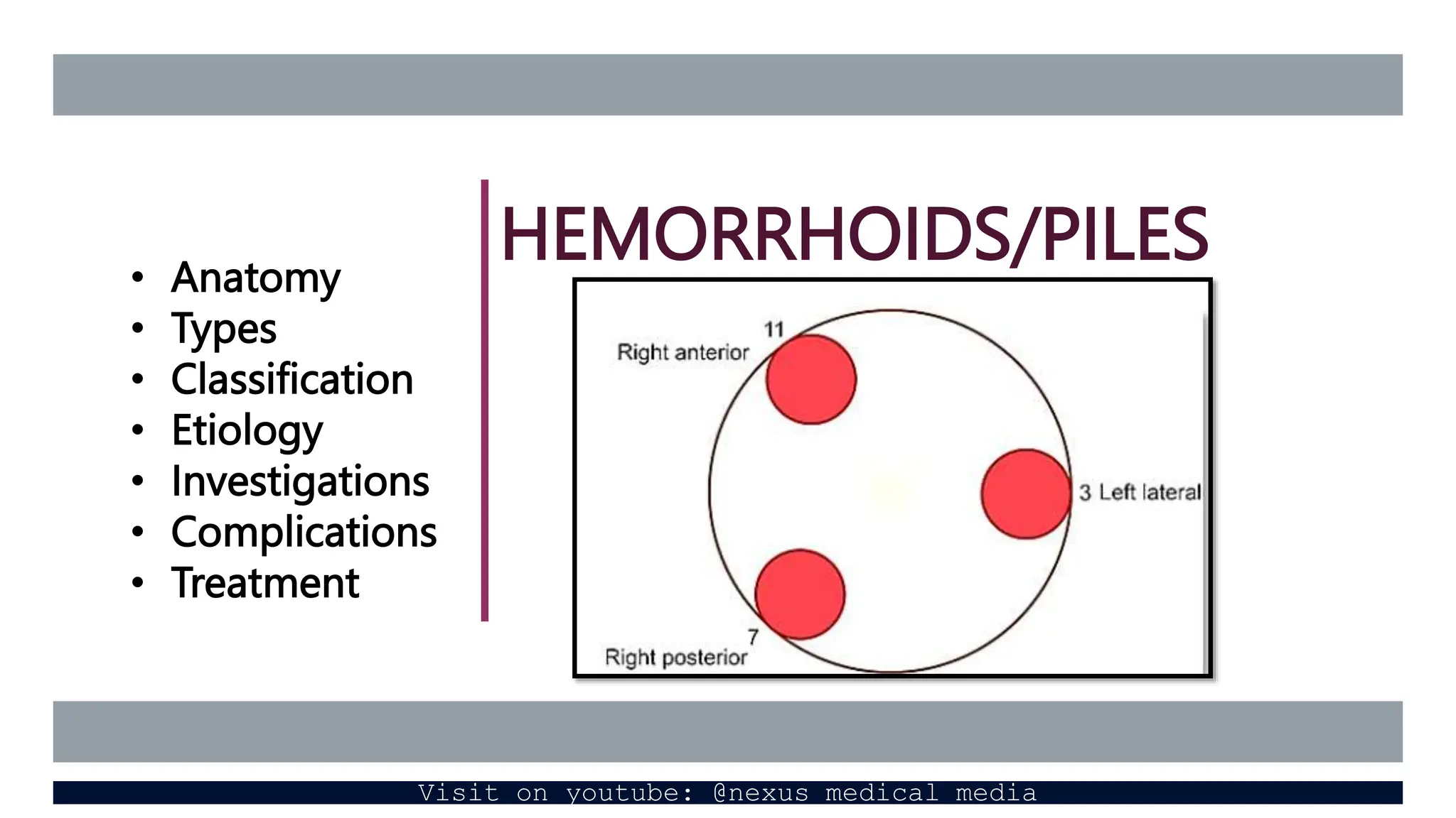 HEMORRHOIDS- anatomy, pathophysiology, clinical features, diagnosis and management.pptx