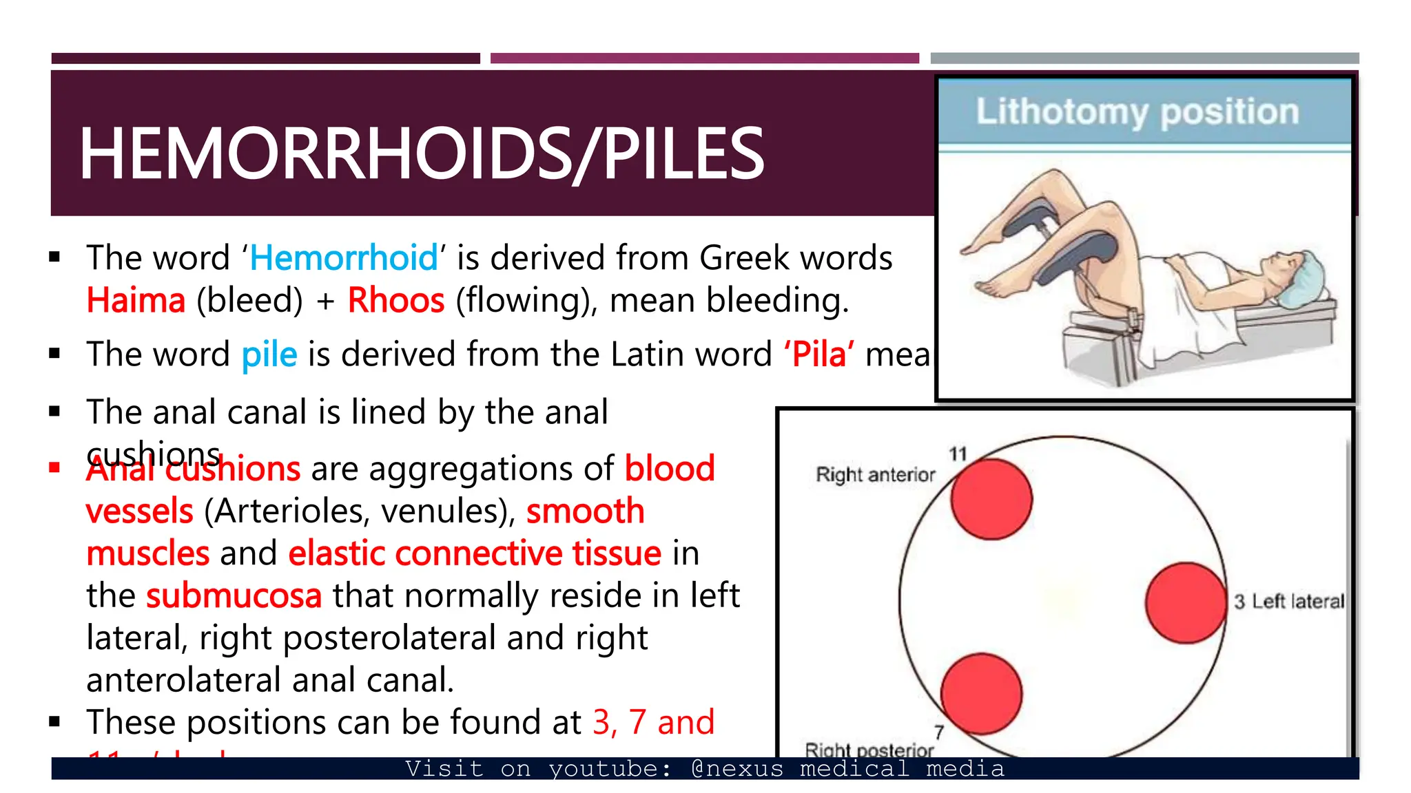 HEMORRHOIDS- anatomy, pathophysiology, clinical features, diagnosis and ...