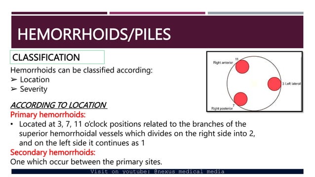 HEMORRHOIDS- anatomy, pathophysiology, clinical features, diagnosis and ...