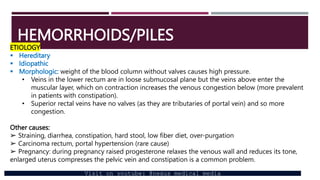 HEMORRHOIDS- anatomy, pathophysiology, clinical features, diagnosis and ...