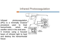 HEMORRHOIDS.pptx for bsc nursing ppt.................. | PPT