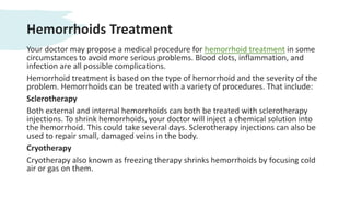 Hemorrhoids- How You Can Treat Them.pdf