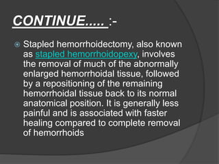 hemorrhoids (1).pptx