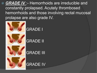 hemorrhoids (1).pptx | Blood Disorders | Diseases and Conditions