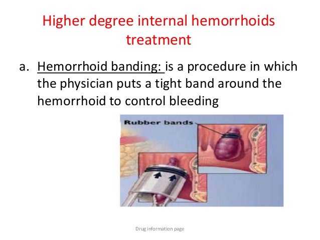 Hemorrhoids drug information page