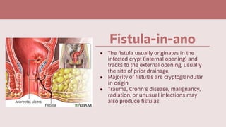 hemorrhoids_fistula.pptx