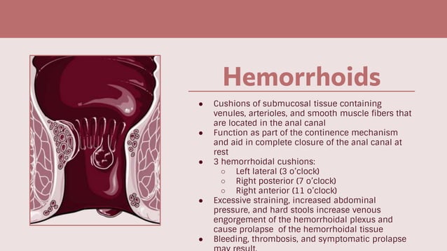 hemorrhoids_fistula.pptx