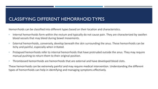 Hemorrhoids in Women & Men - What You Need to Know.pdf