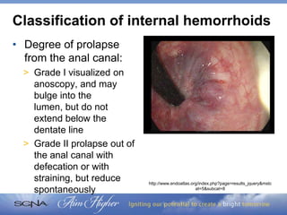 Kiss Your Hemorrhoids Goodbye: Surgical and Non-Surgical Management ...