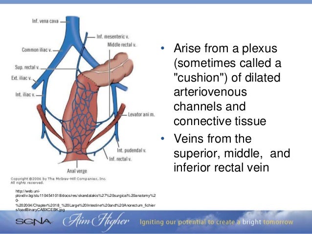 Kiss Your Hemorrhoids Goodbye: Surgical and Non-Surgical Management O…