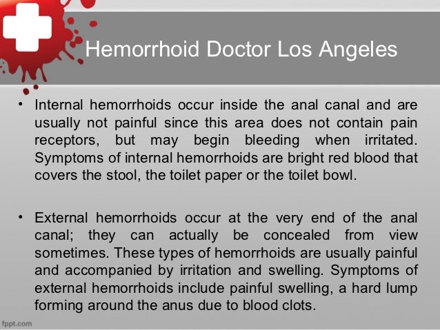 External Hemorrhoid With Blood Clot