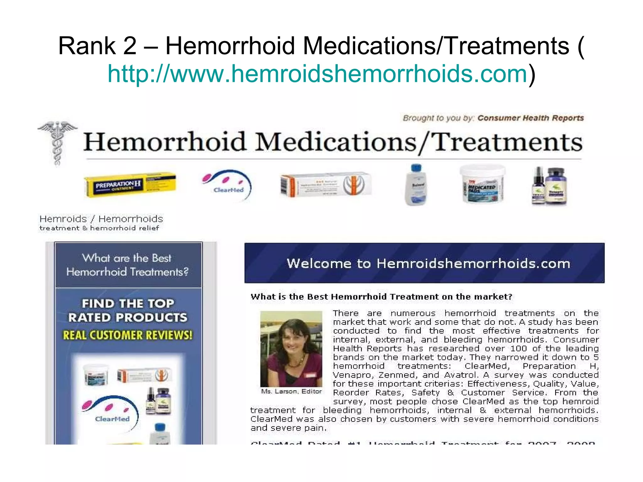 Top Five Hemorrhoid Treatments | PPT