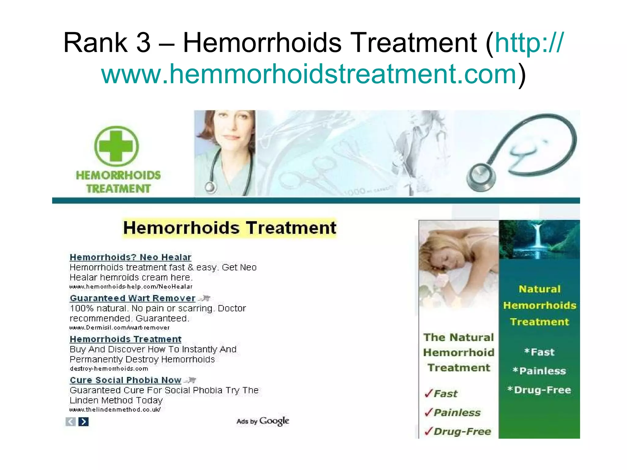 Top Five Hemorrhoid Treatments | PPT