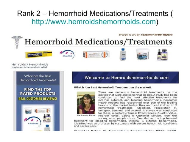 Top Five Hemorrhoid Treatments | PPT