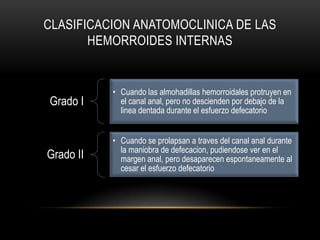 Hemorroides-Clasificación De Las Hemorroides – 1st Wave