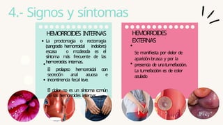 hemorroides, concepto, signos y sintomas-ppt.pptx