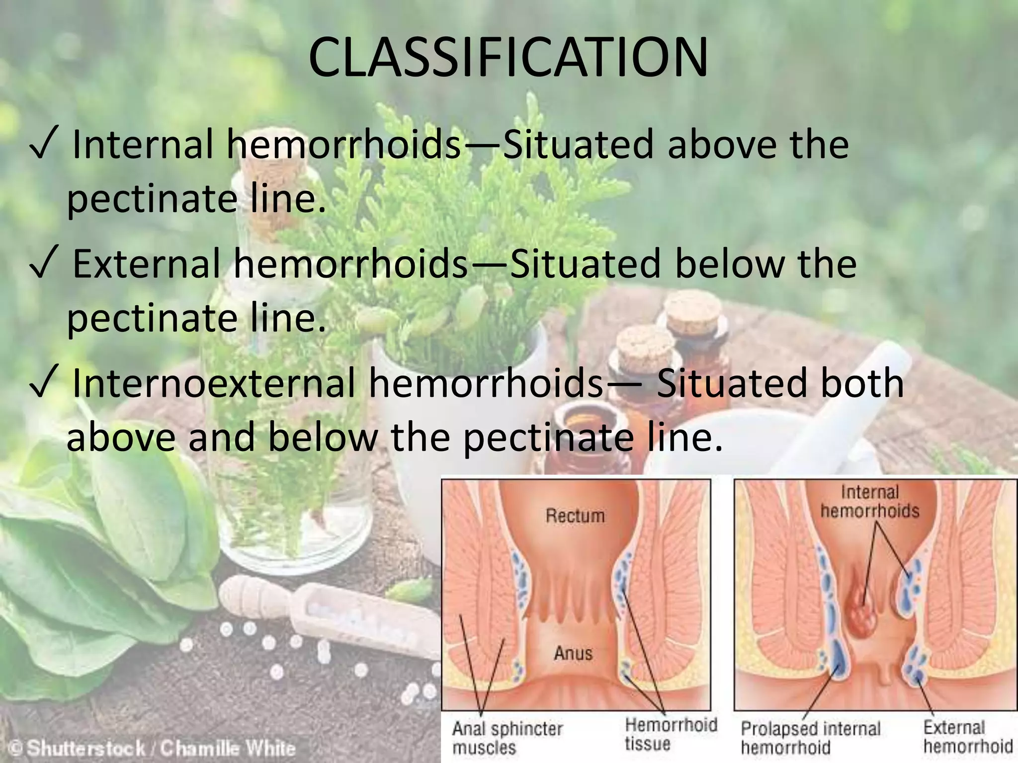 Hemorroids | PPT