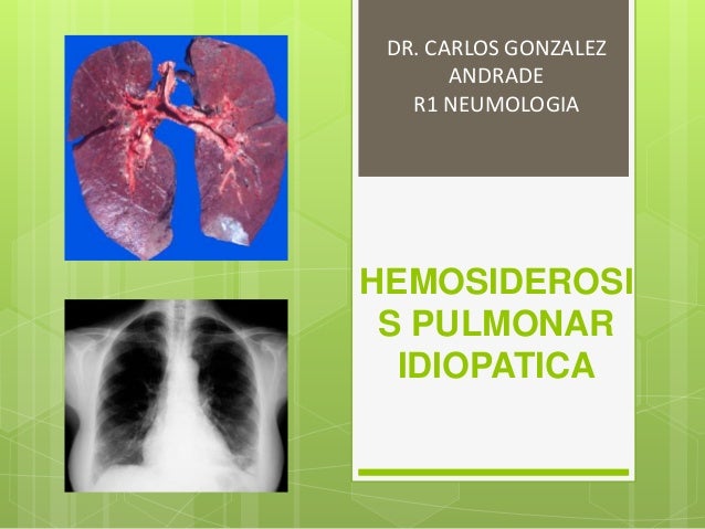 Hemosiderosis pulmonar idiopatica