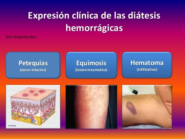 Hemostasia