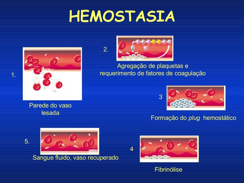 Hemostasia
