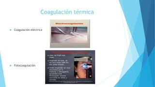 TECNICA QUIRURGICA - HEMOSTASIS | PPTX