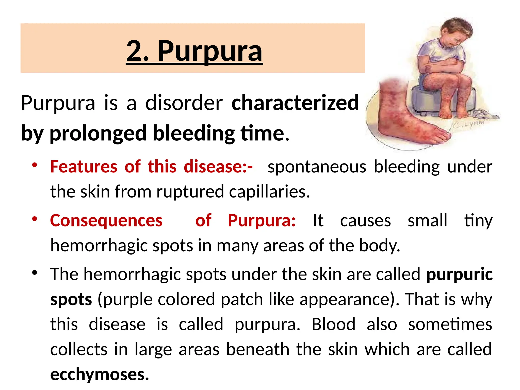 Hemostasis, (Blood clotting), Blood Coagulation, Clot retraction. pptx ...
