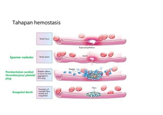 Hemostasis _ pembekuan darah, golongan darah.docx