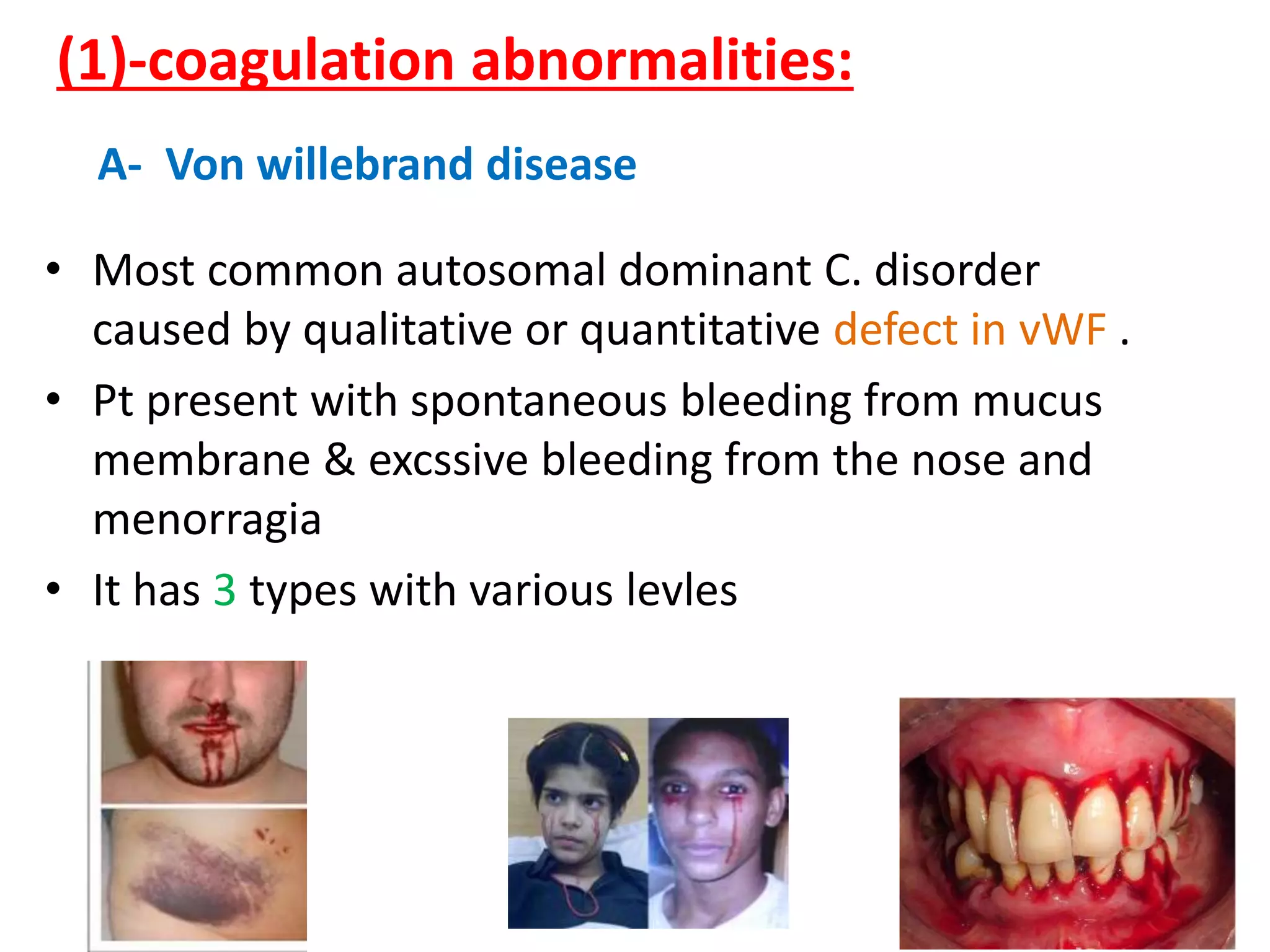 Hemostatic abnormalities | PPTX