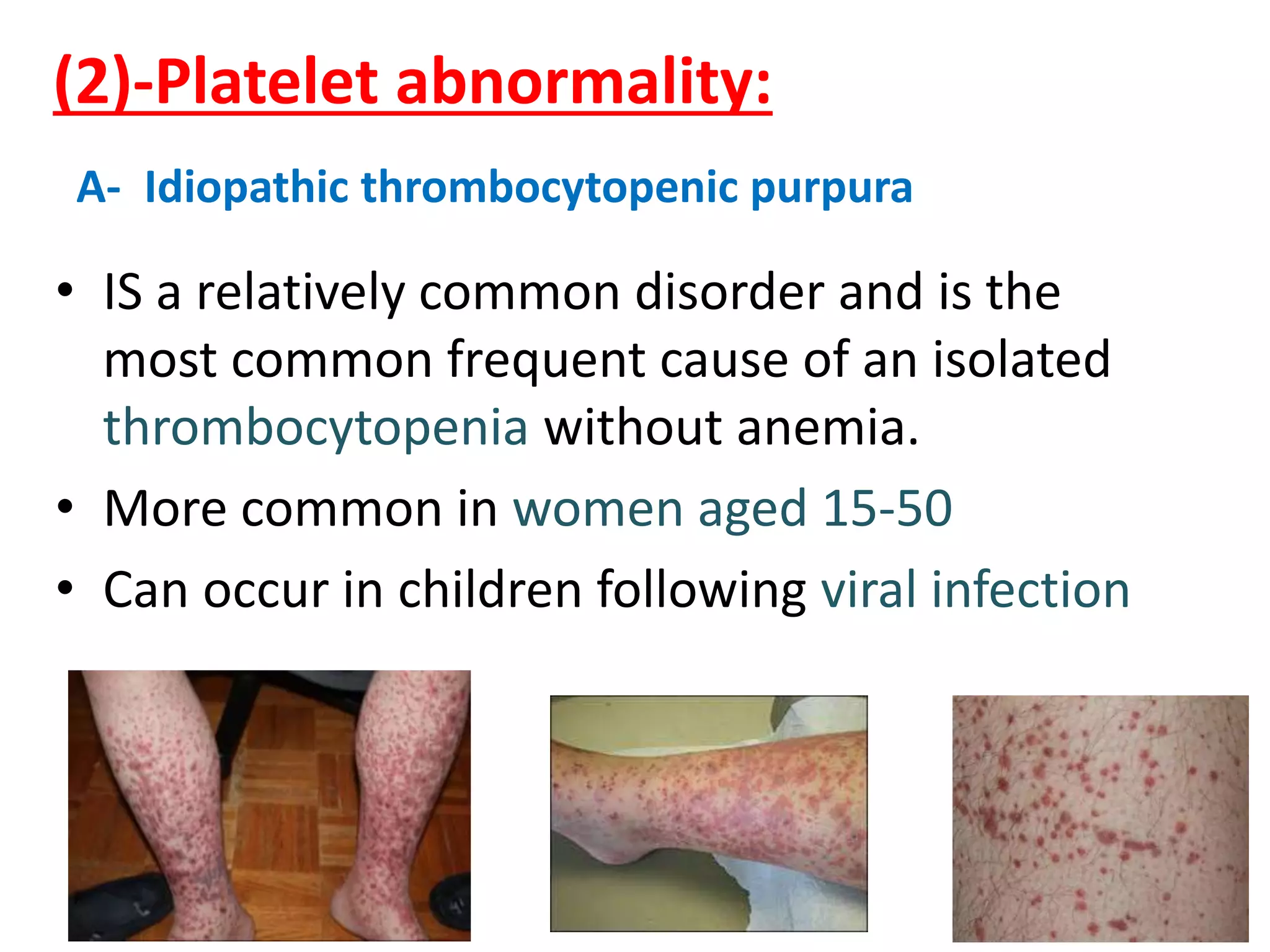 Hemostatic abnormalities | PPTX