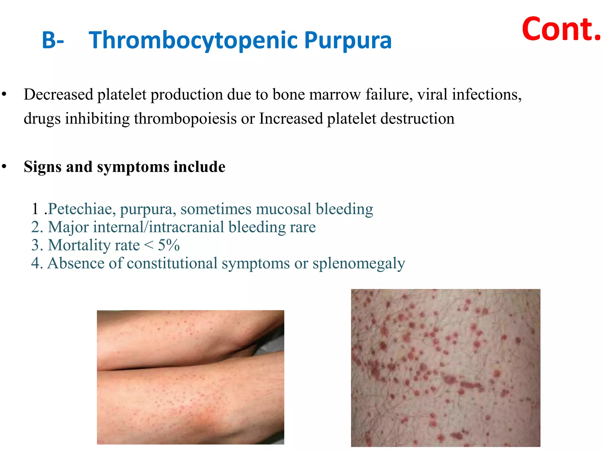 Hemostatic abnormalities | PPTX