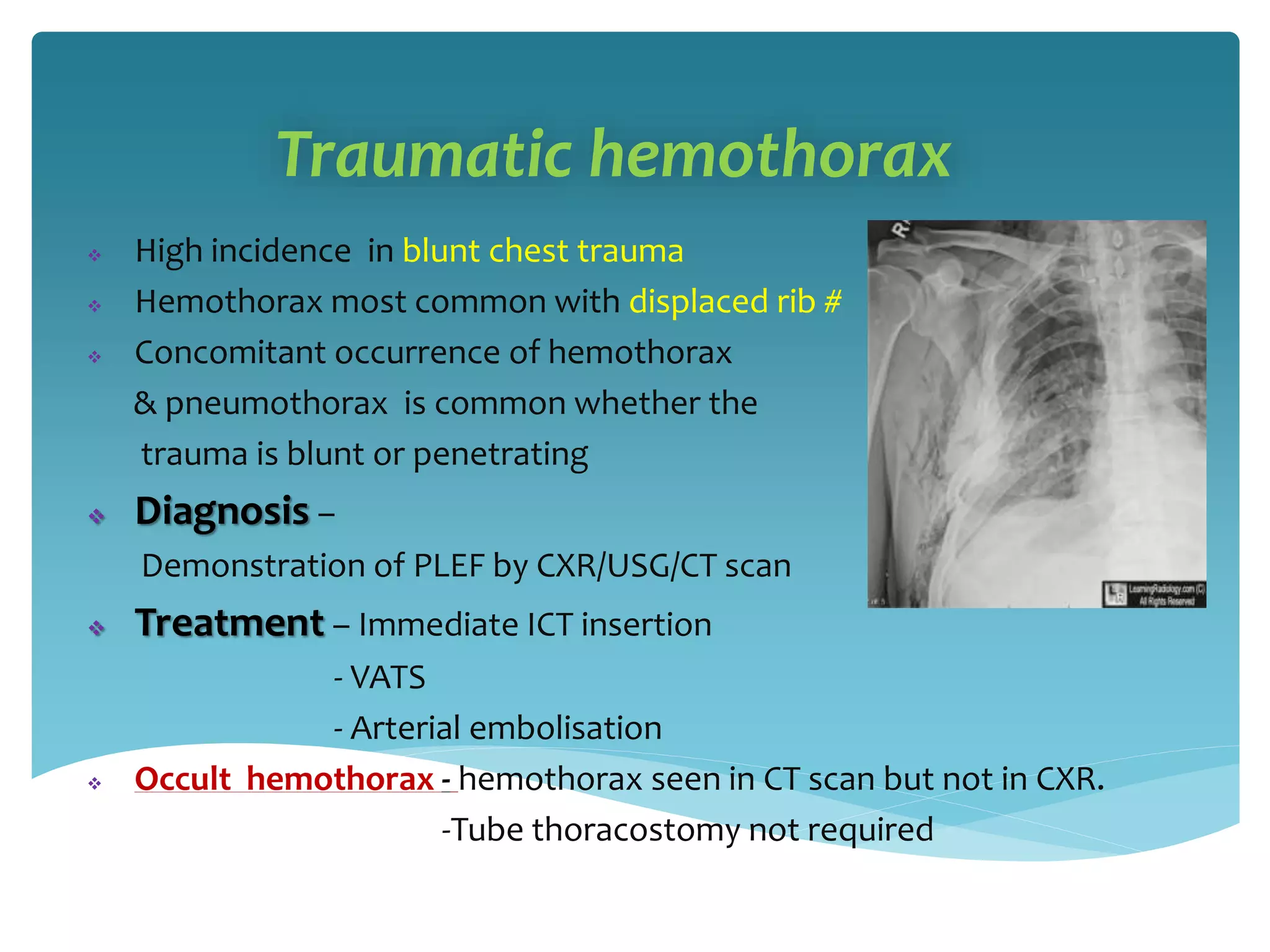 Hemothorax | PPTX
