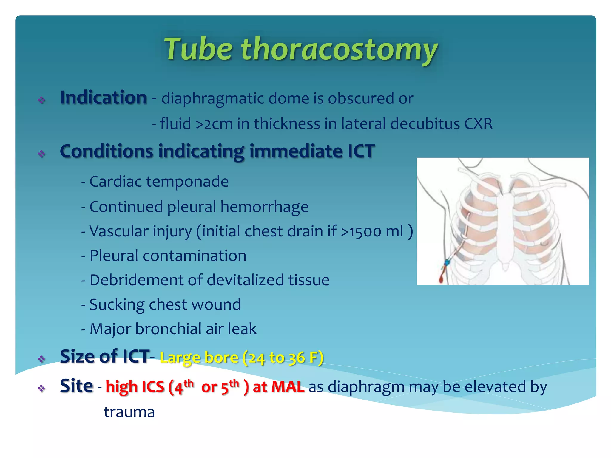 Hemothorax | PPTX
