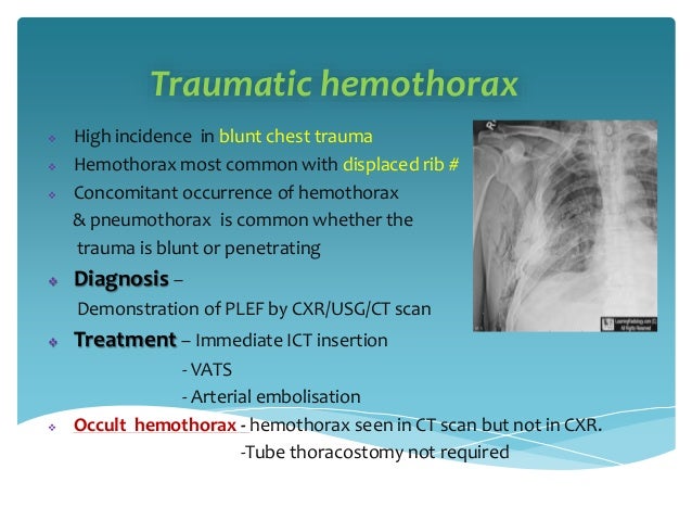 Hemothorax