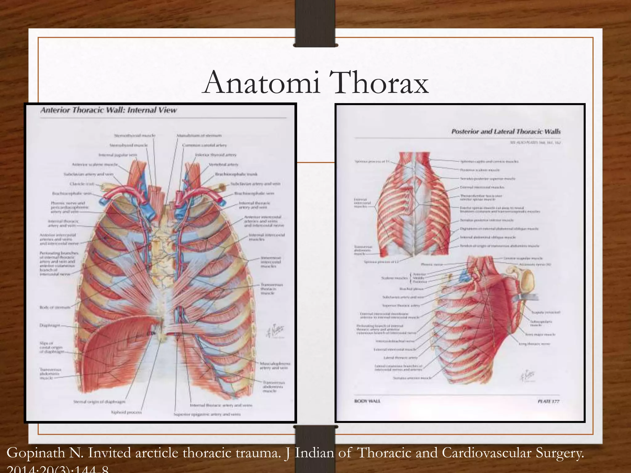 Hemothorax | PPT
