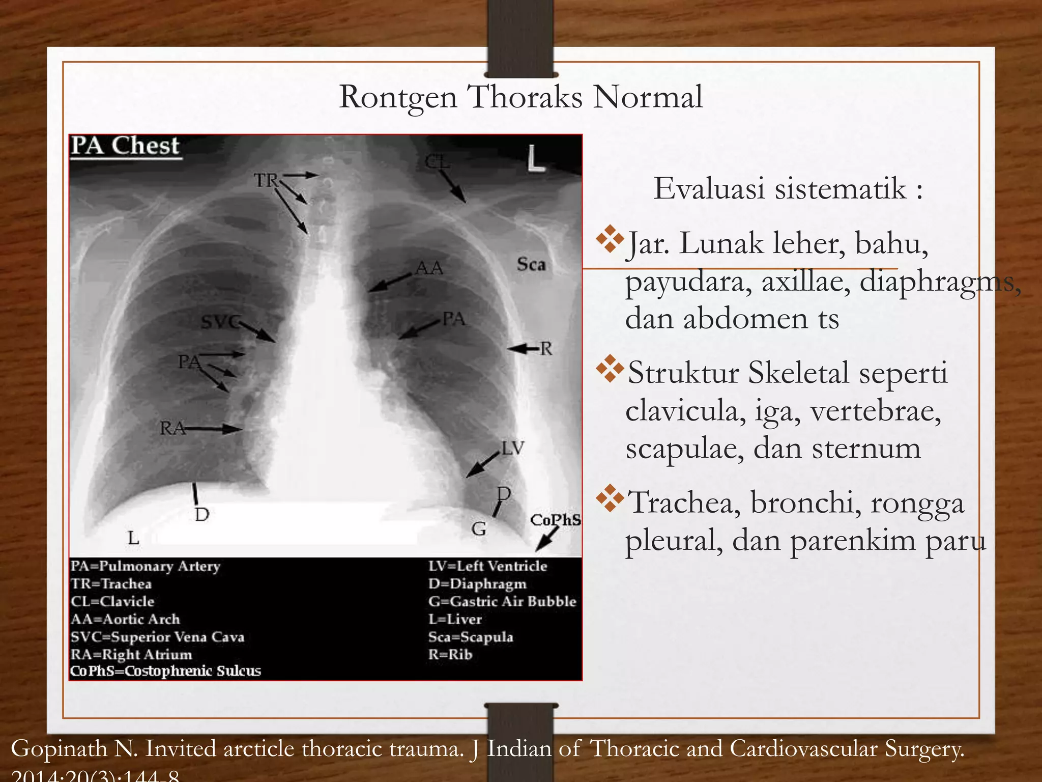 Hemothorax | PPT