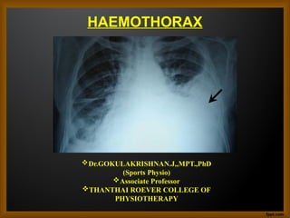 Comprehensive Overview of Haemothorax: Causes, Diagnosis, and ...