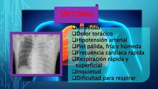 Hemotorax | PPTX