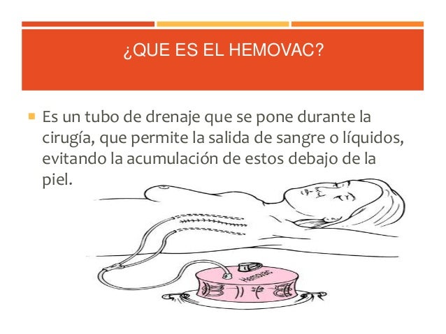 Hemovac