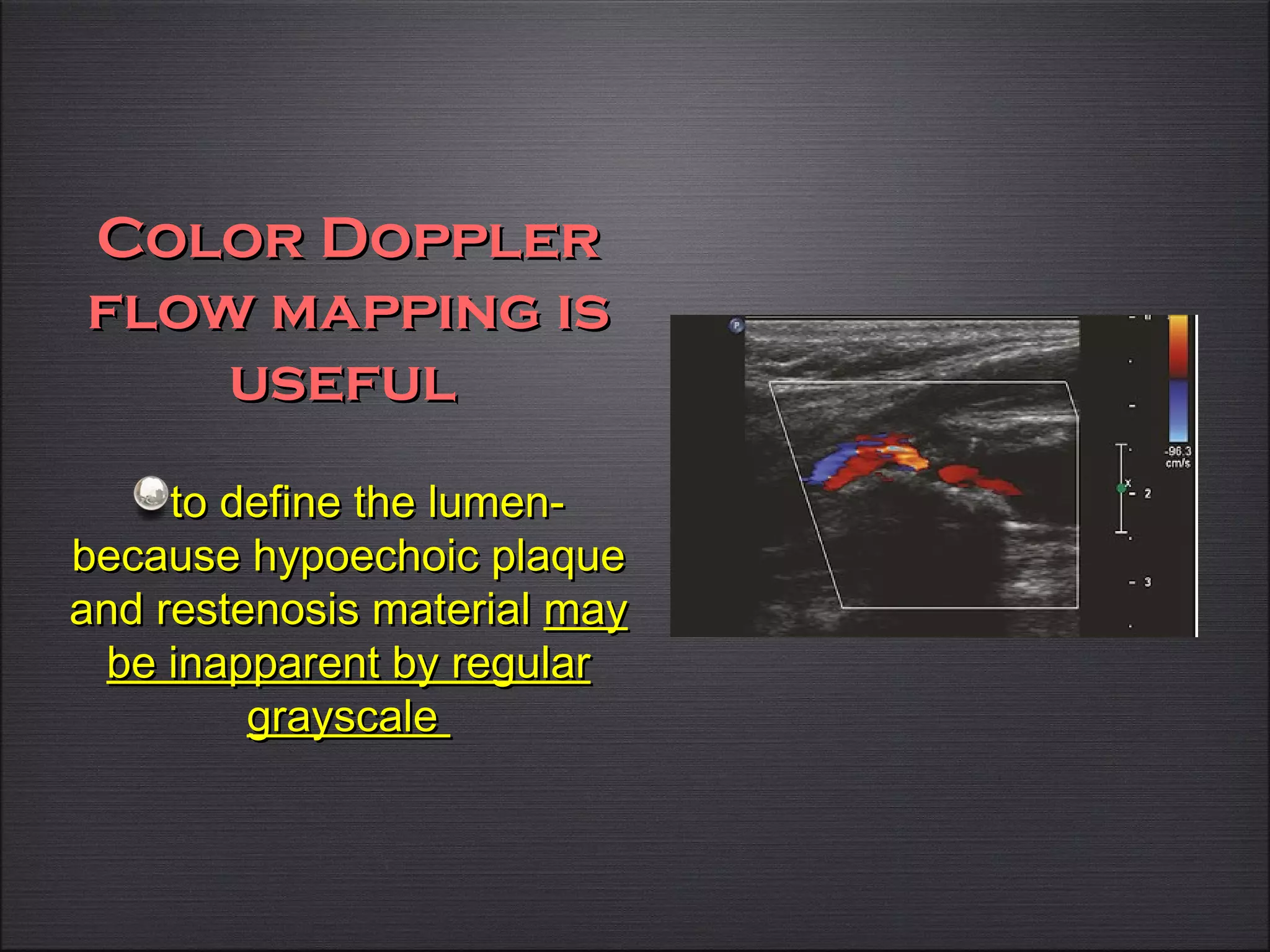 Vascular Ultrasound | PPT