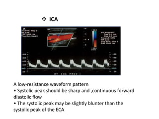 carotid doppler u/s Radiology | PPTX