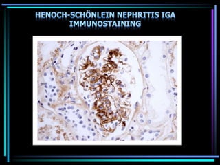 Henoch | PPTX