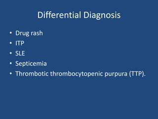 Henoch schenolin purpura.pptx