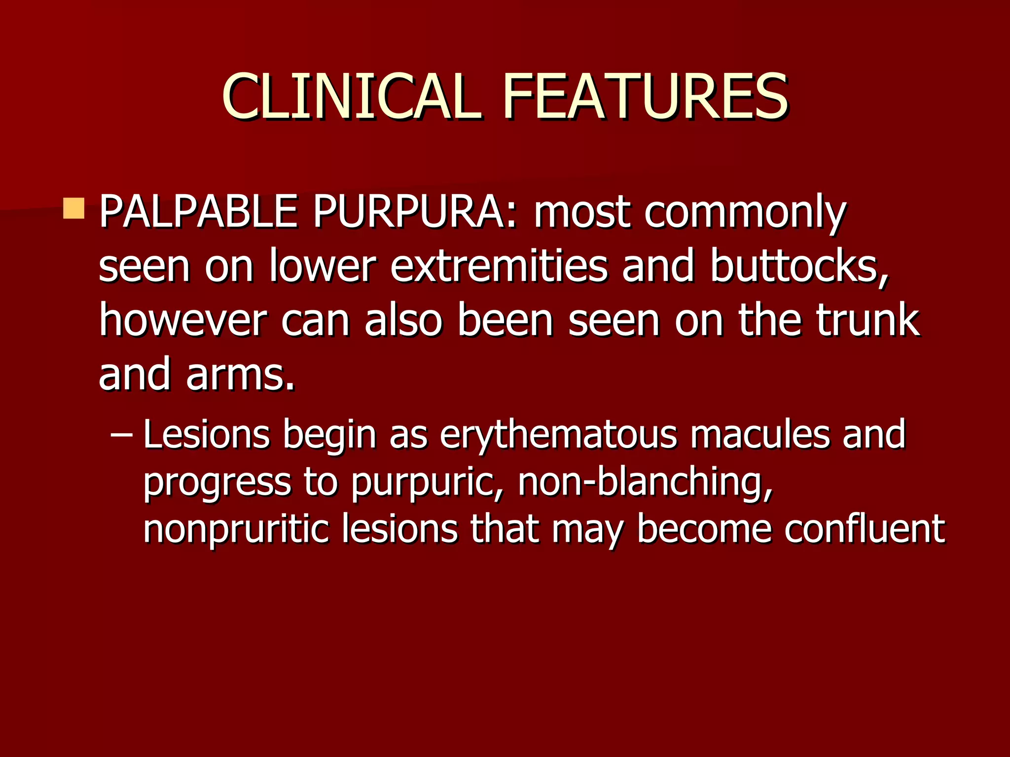 Henoch Schonlein Purpura | PPT