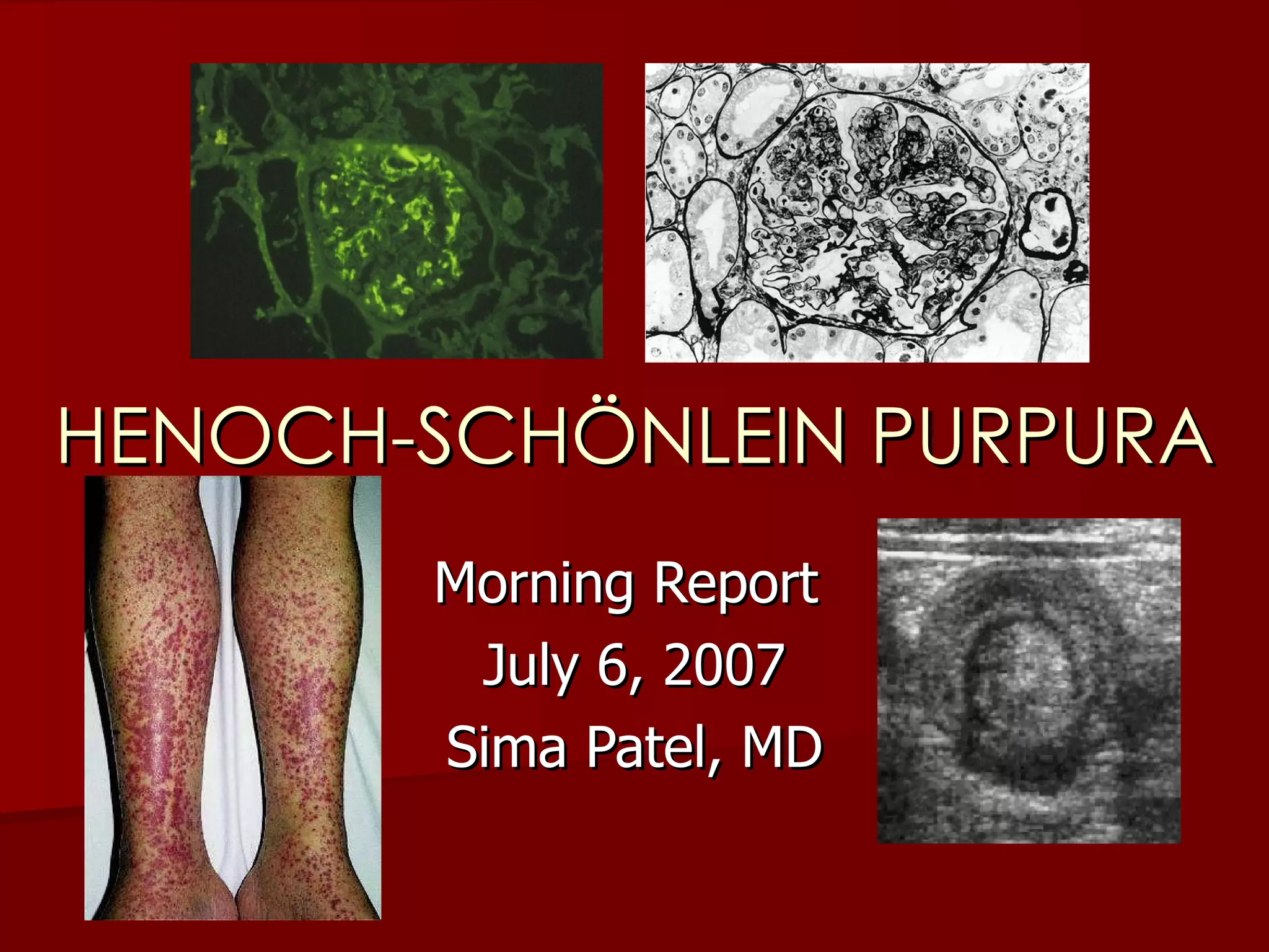 Henoch Schonlein Purpura | PPT
