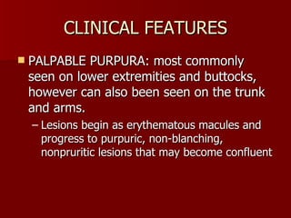Henoch Schonlein Purpura | PPT