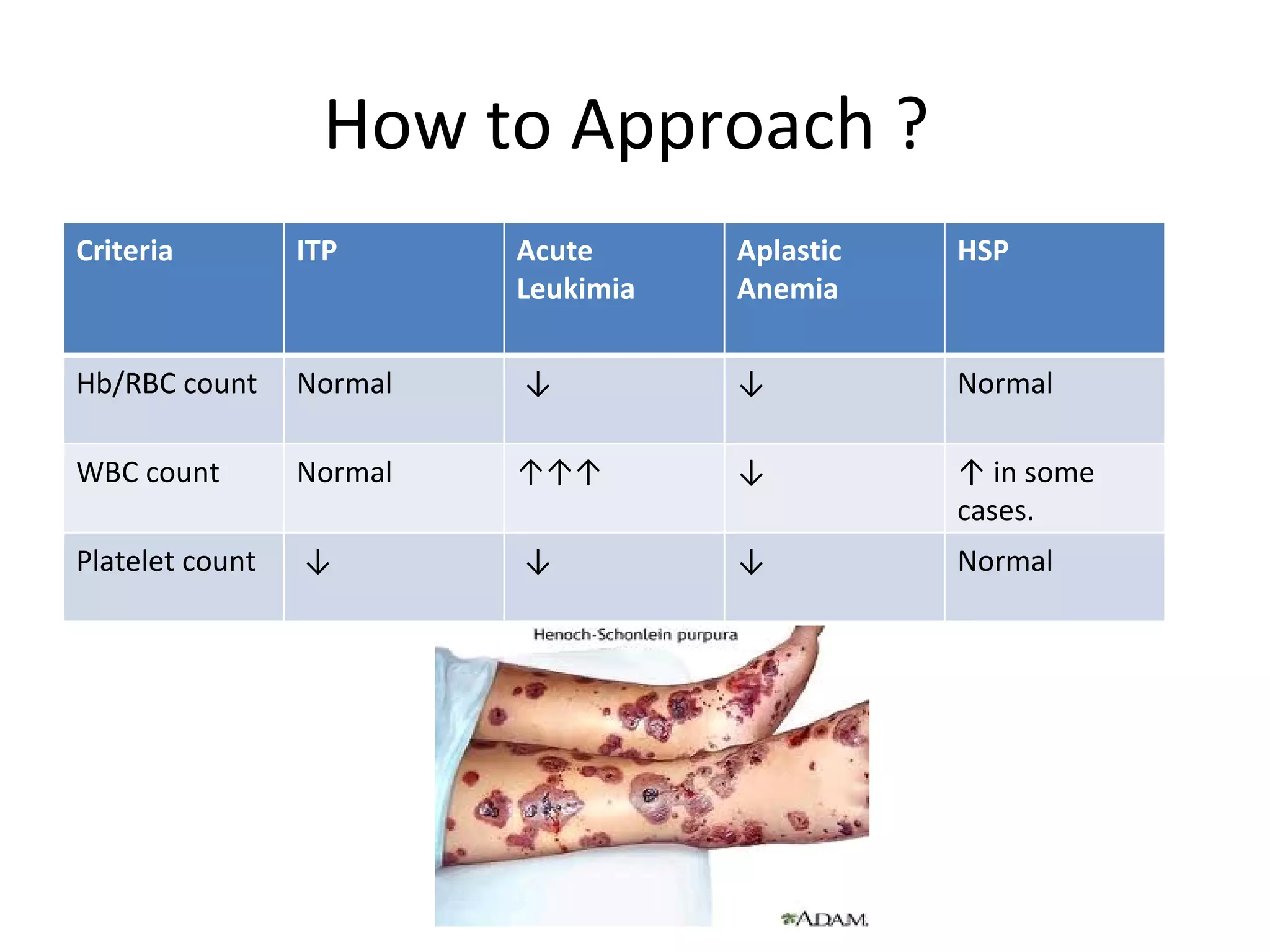 Henoch Schonlein Purpura | PPT