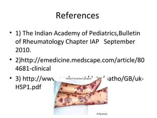 Henoch Schonlein Purpura | PPT