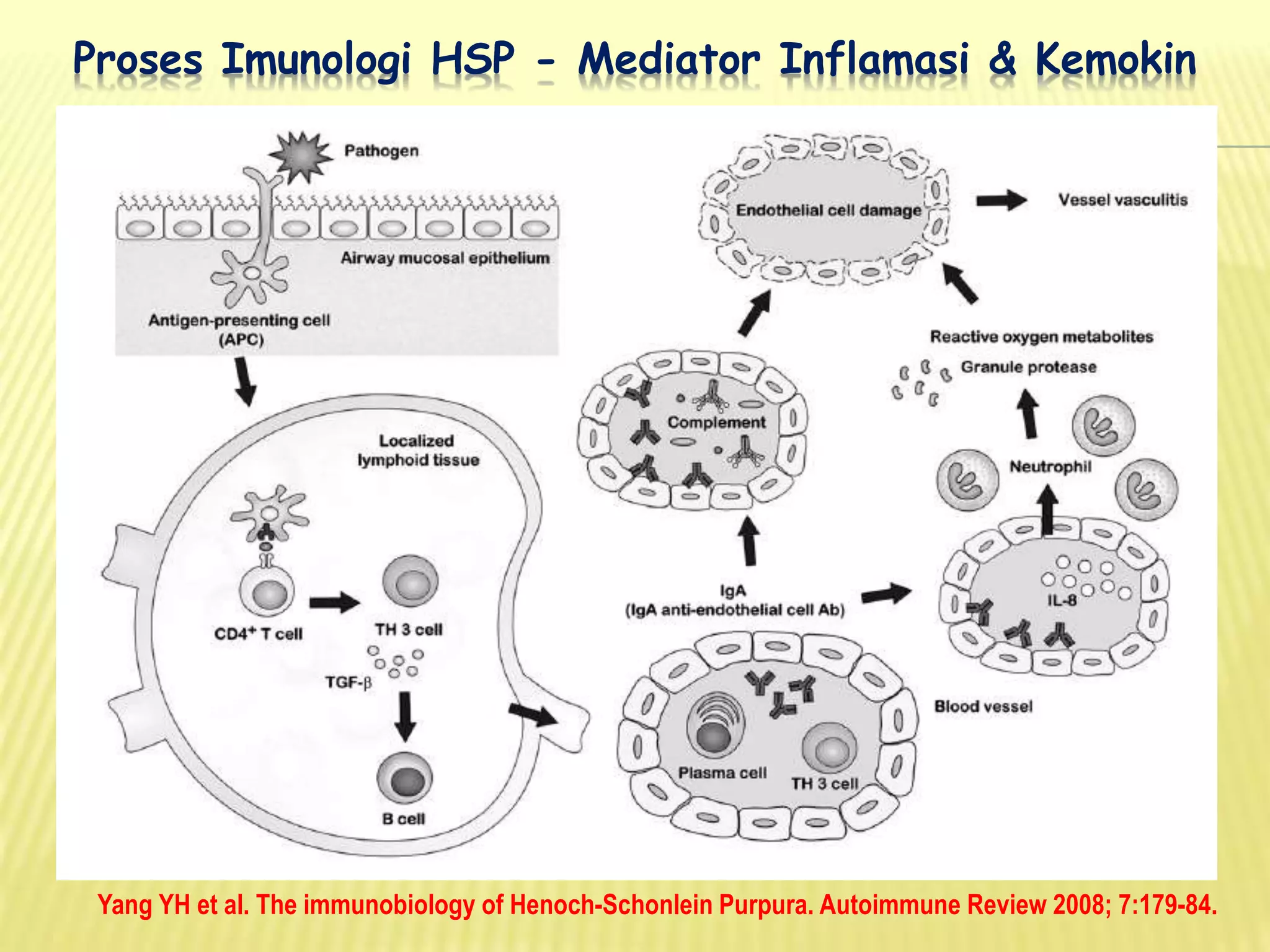 Immunopathogenesis Leukocytoclastic Vasculitis in Henoch Schonlein Purpura | PPT