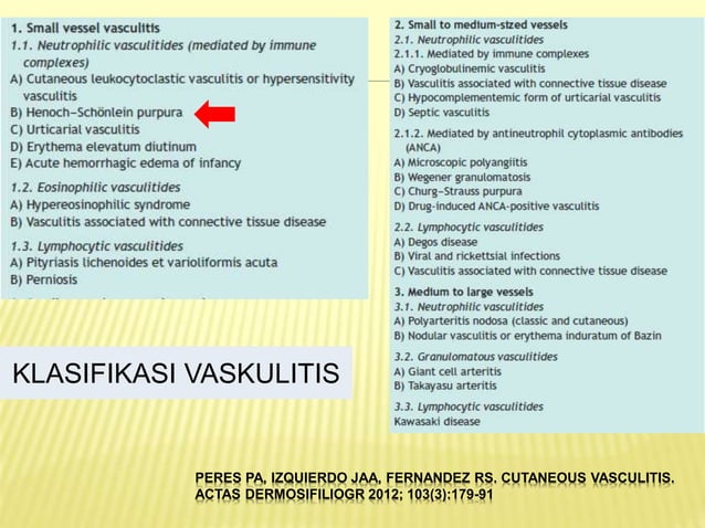 Immunopathogenesis Leukocytoclastic Vasculitis in Henoch Schonlein ...